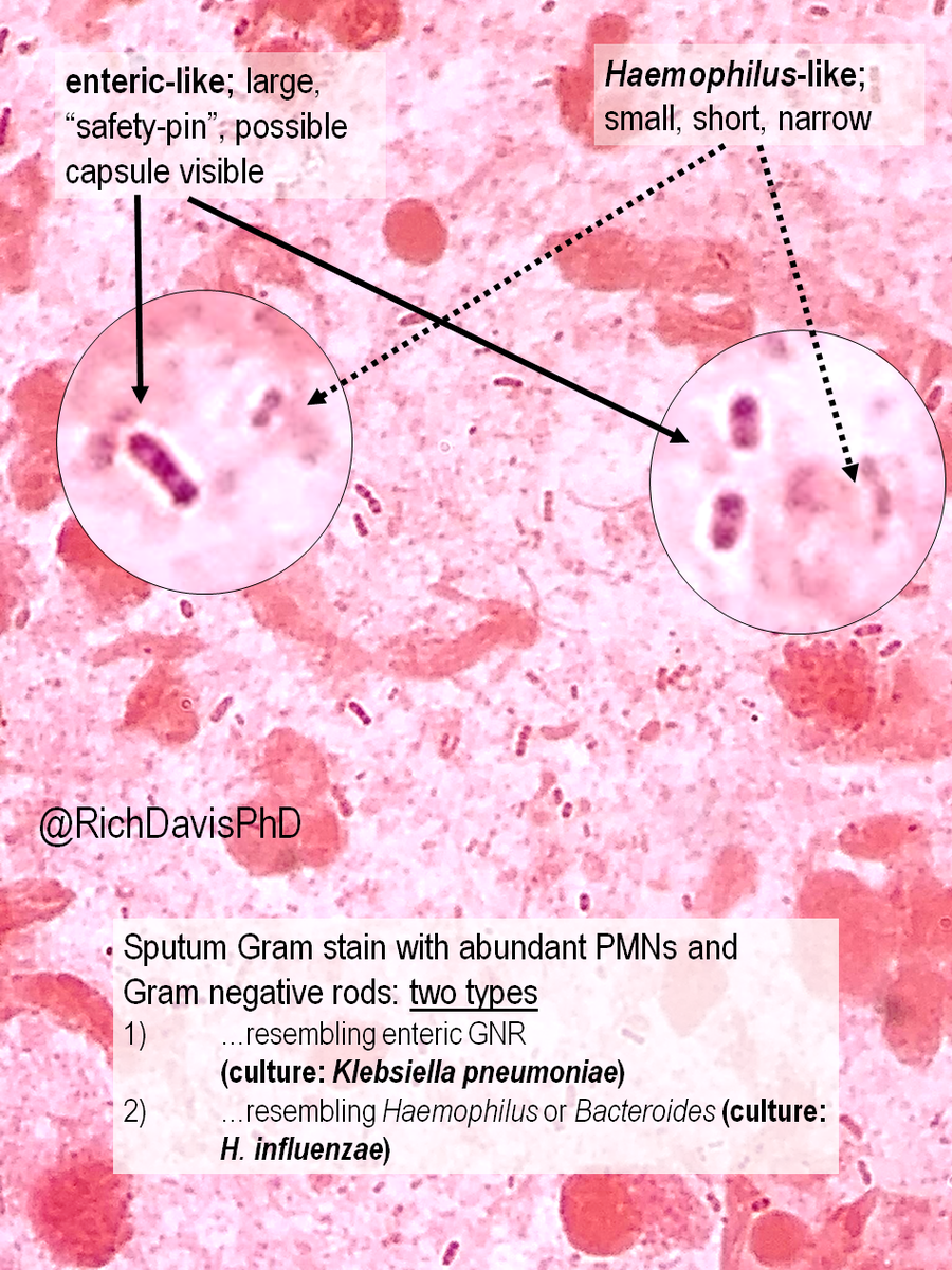 Haemophilus Gram Stain