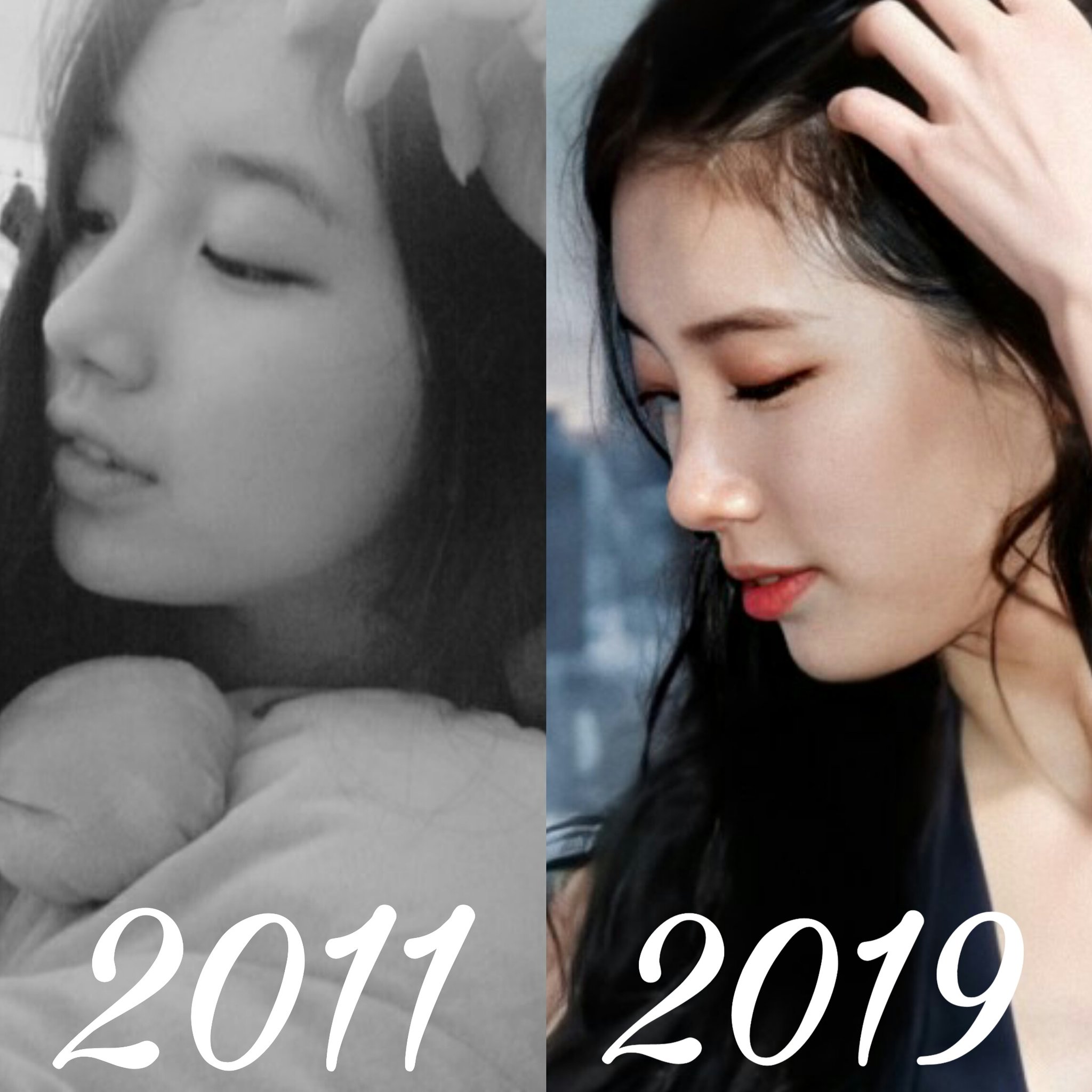 Suzy Plastic Surgery