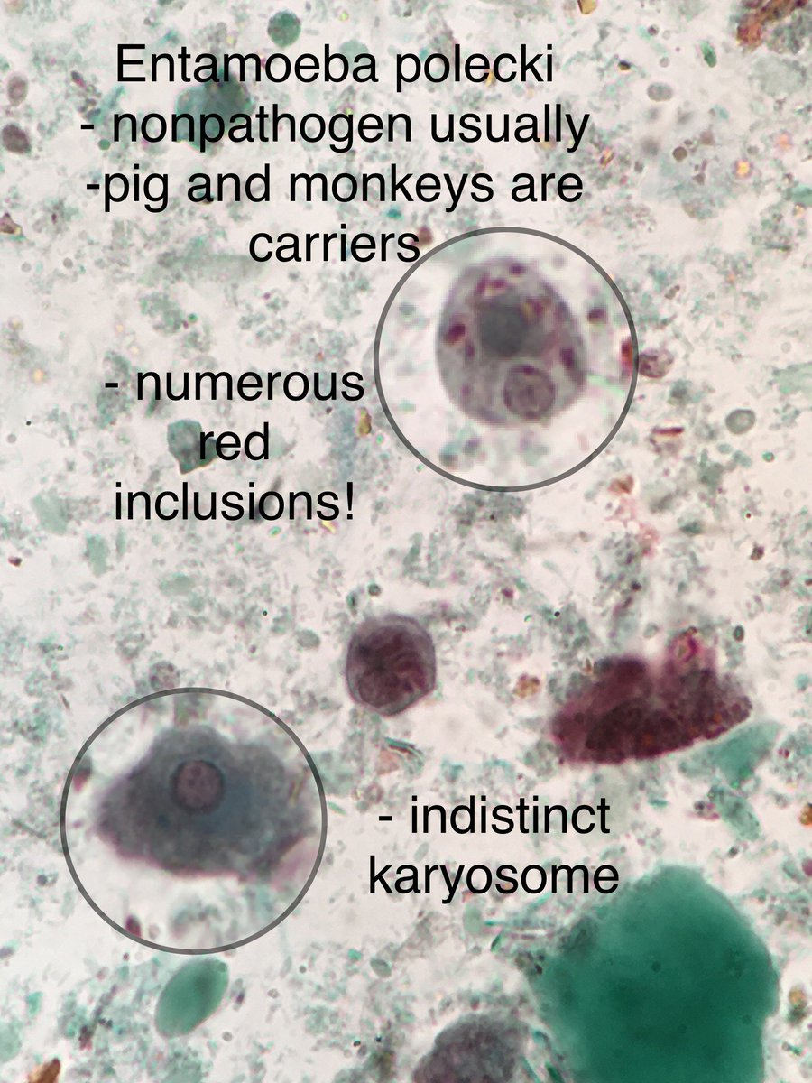 Entamoeba Polecki Cyst