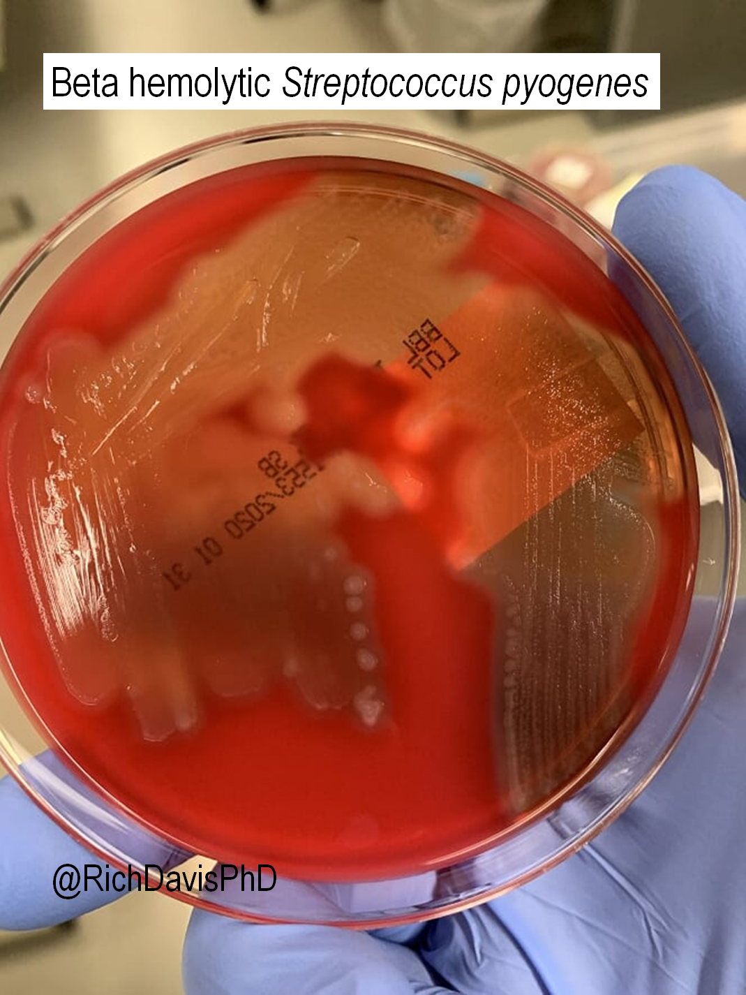 Blood Agar Streptococcus Pyogenes