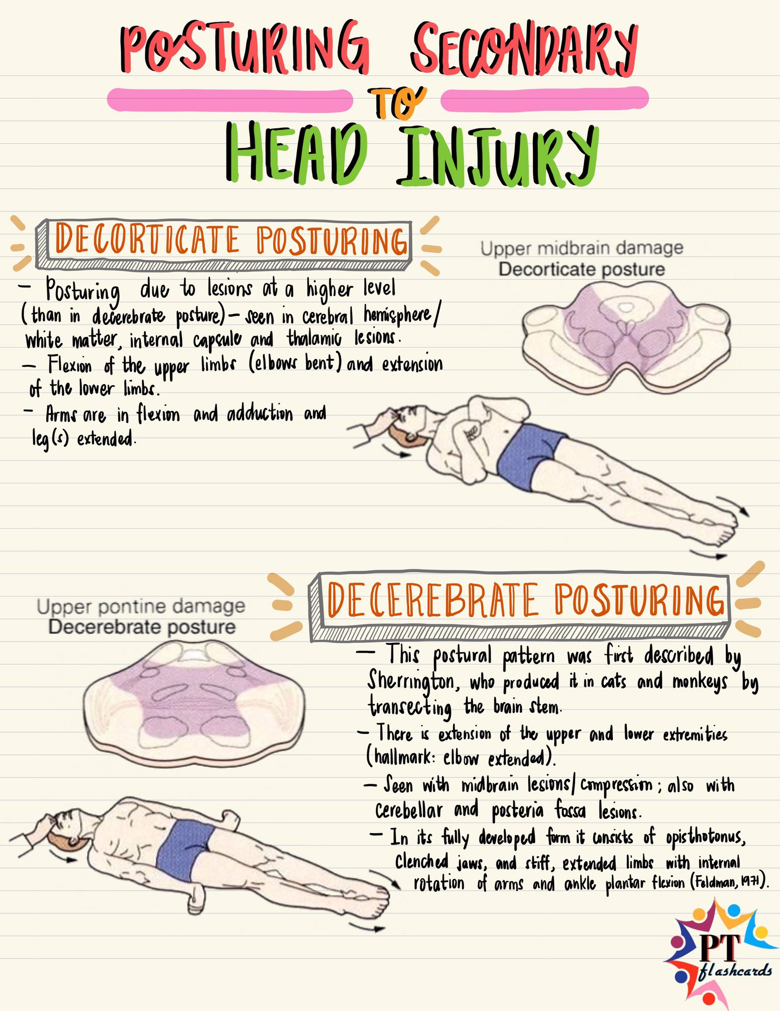 Abnormal Posturing Brain Injury