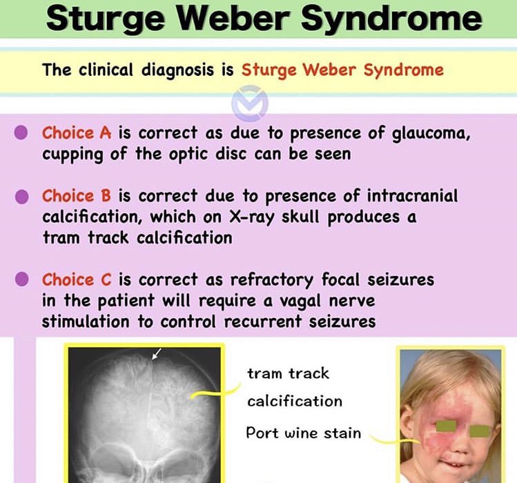 Tramline Intracranial Calcifications