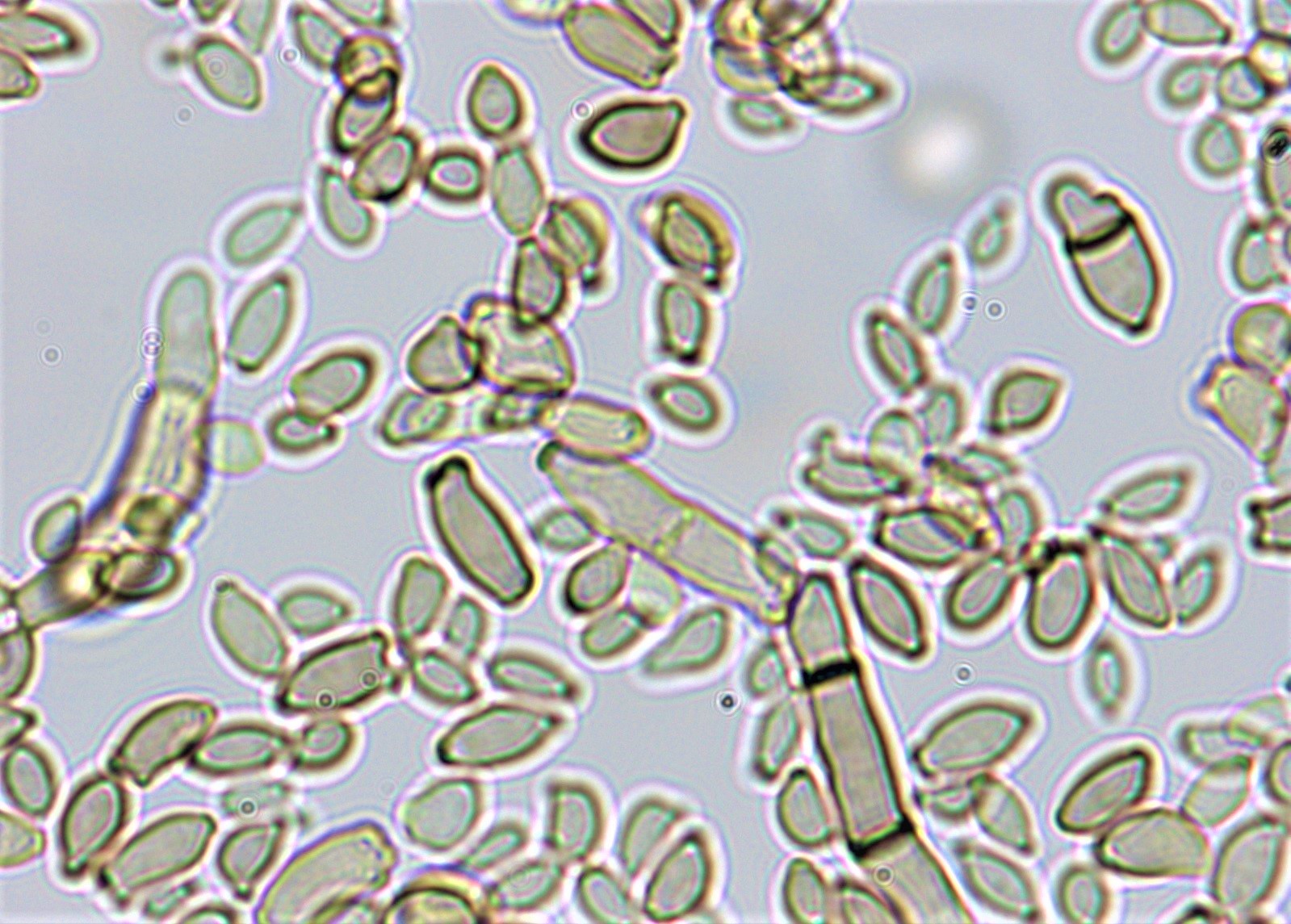 Cladosporium Spores