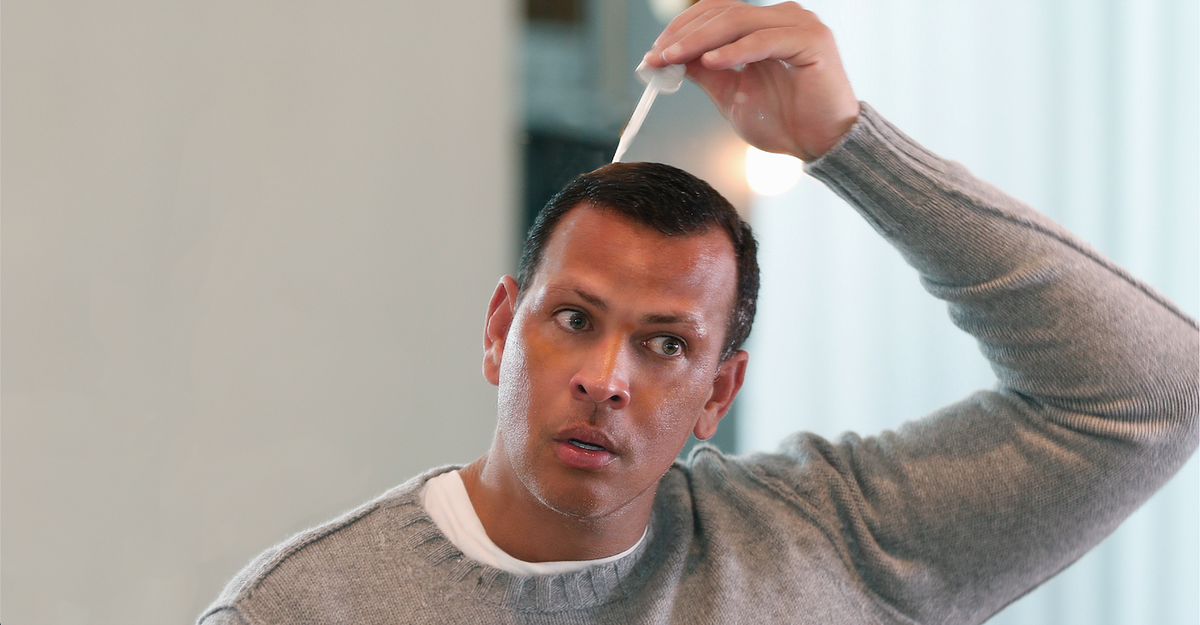 Alex Rodriguez Hair Transplant