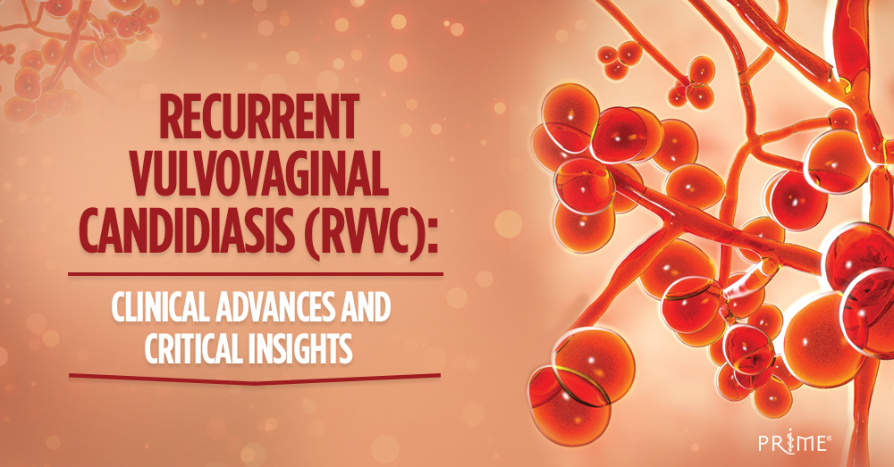 Recurrent Vulvovaginal Candidiasis