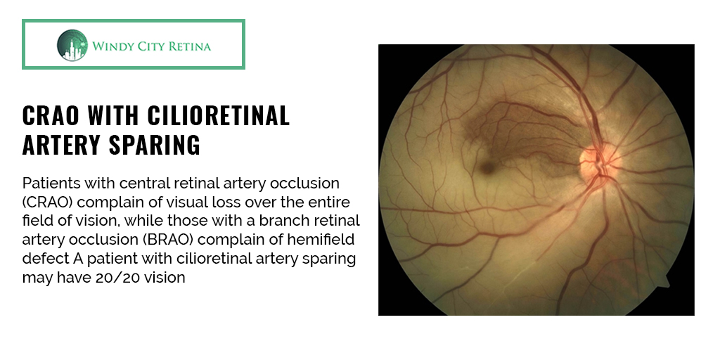 Cilioretinal Artery Occlusion