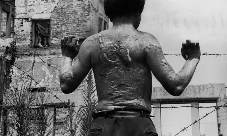 Atomic Bomb Human Shadows Atomic Bomb Human Shadows