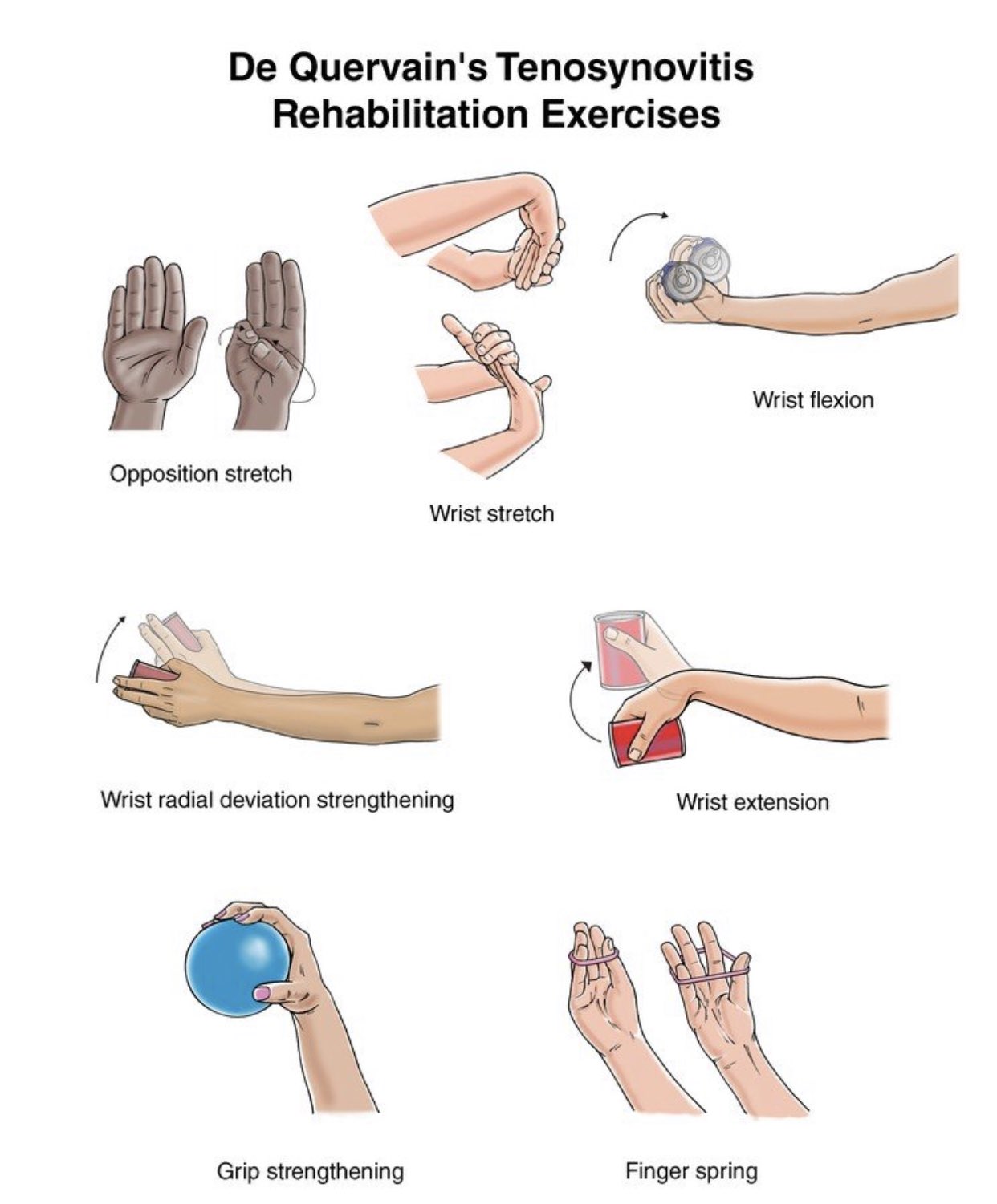 WHAT TEST FOR DE QUERVAIN'S DISEASE Wrist TEST FOR DE , 47% OFF