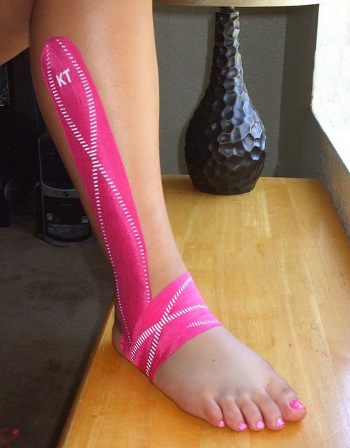 Inversion Ankle Sprain Taping