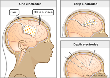 Thread by @dillannewbold: Twitter thesis day 3: Recording of human ...