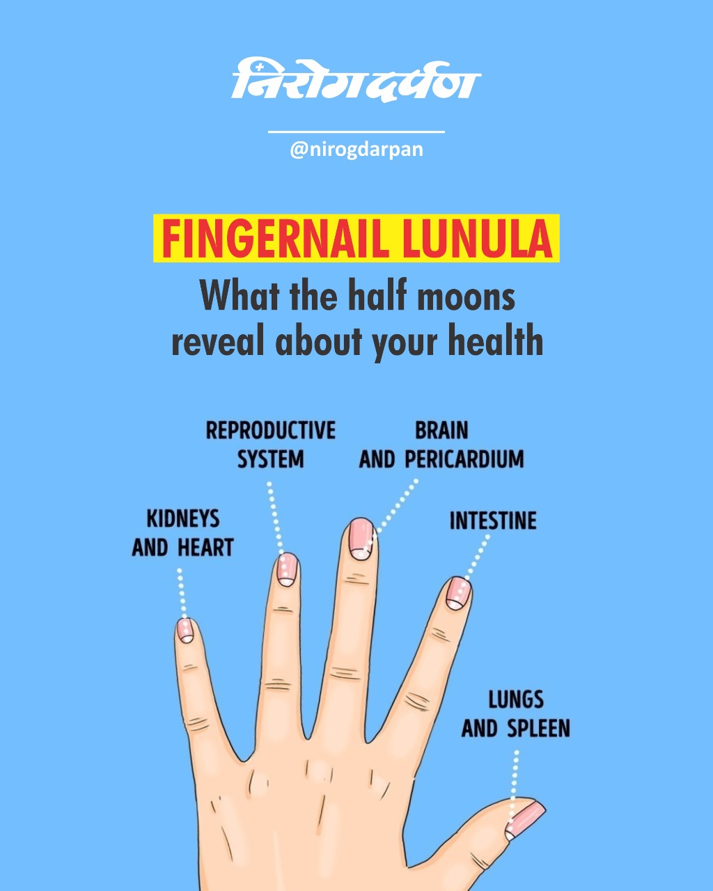 Half Moons On Fingernails Mean Terry's Nails: Symptoms, Causes