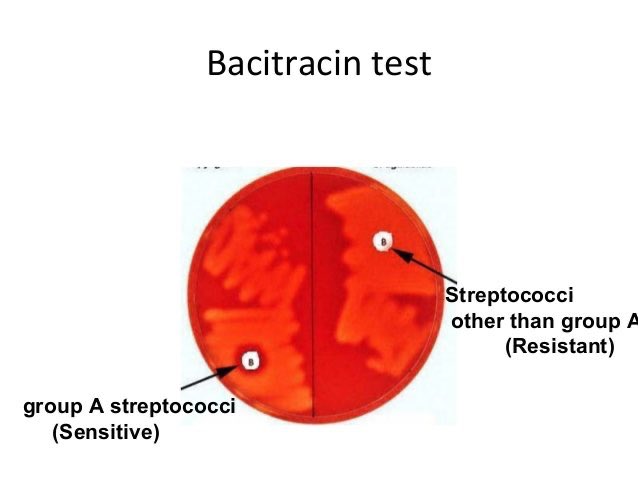 Bacitracin Test