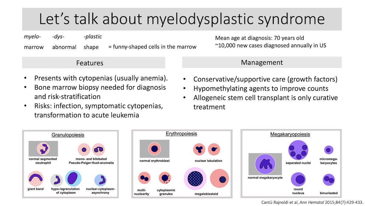 Myelodysplastic Syndrome Myelodysplastic Syndrome: Myelodysplastic
