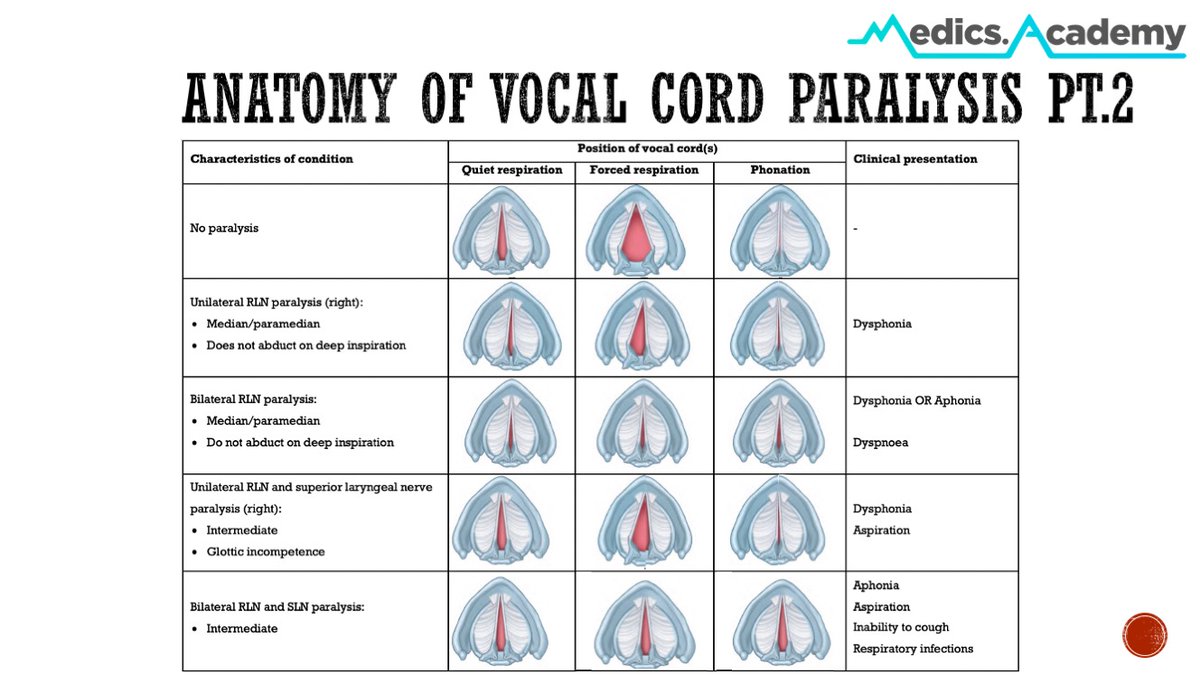 Vocal Cord Paramedian