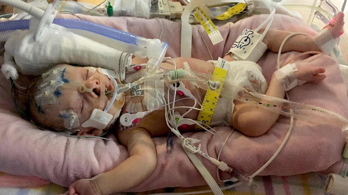 Severe Birth Deformities