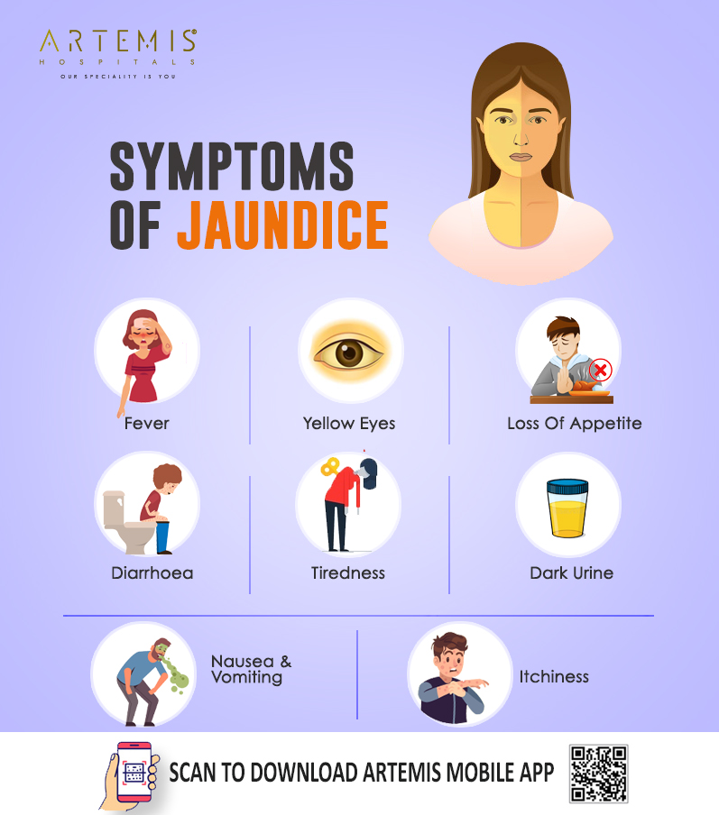 Jaundice Symptoms And Treatment