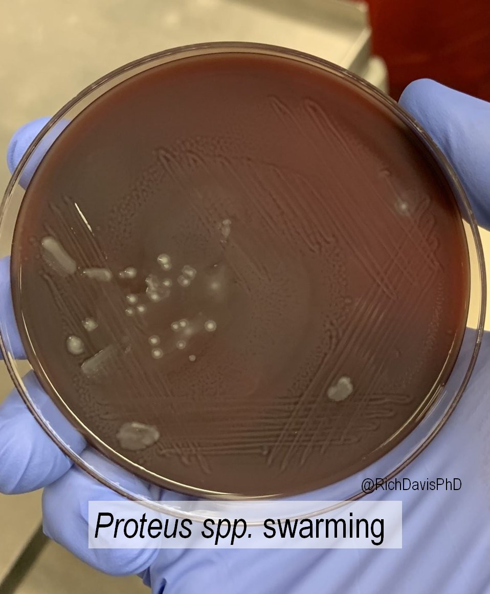 Proteus Mirabilis On Macconkey Agar