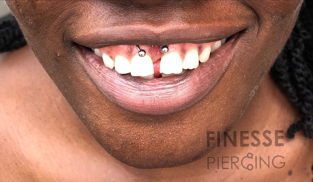 Upper Gum Piercing