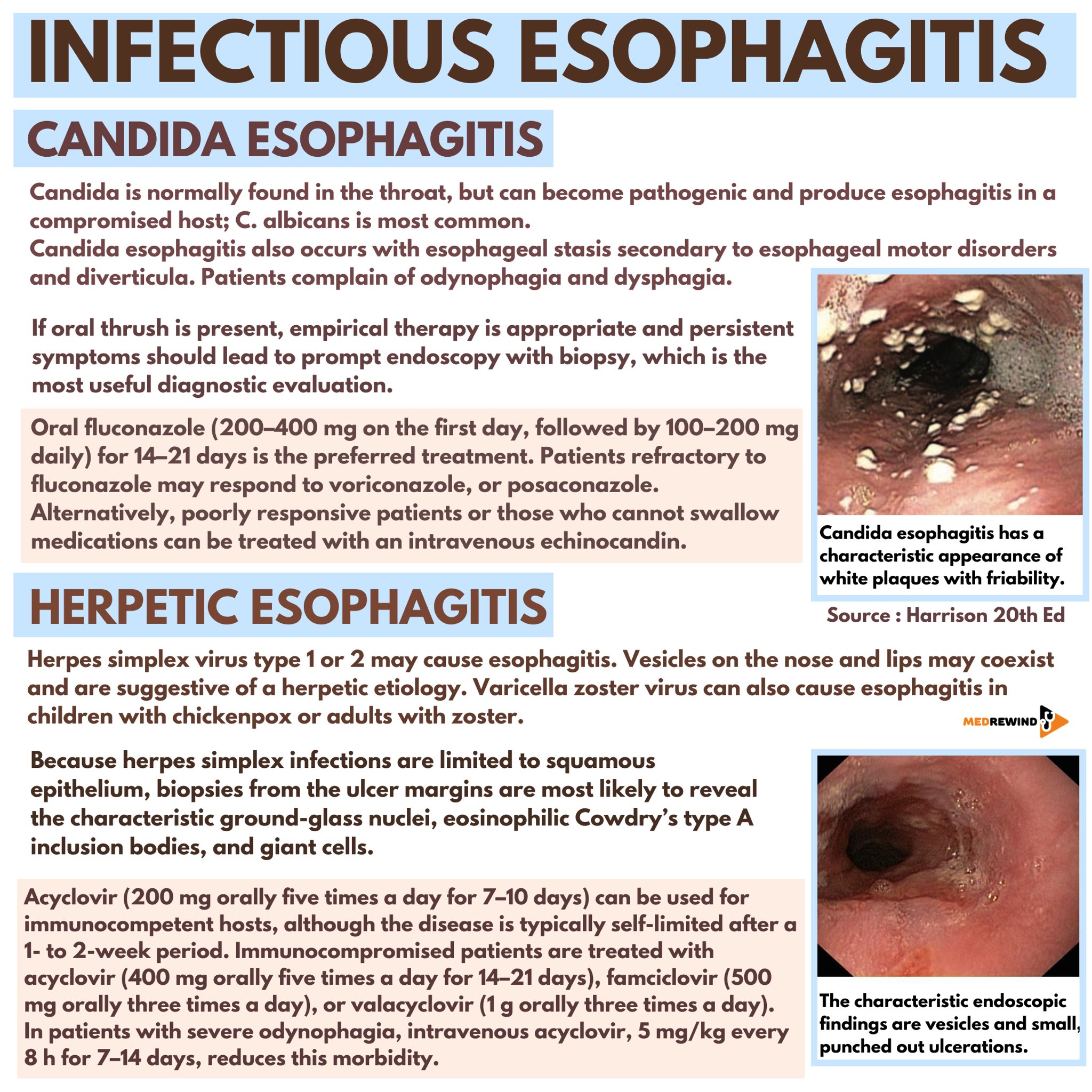 Herpes Esophagitis