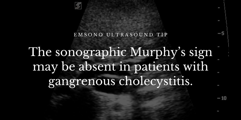 Murphys Sign Cholecystitis