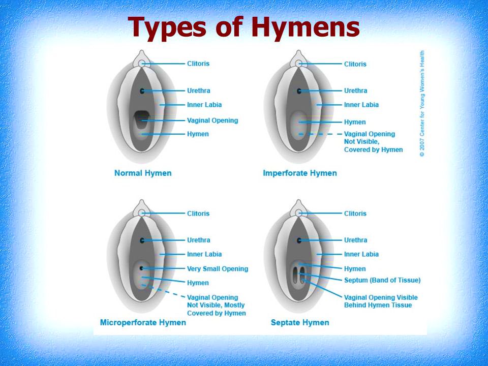 Septate Hymens