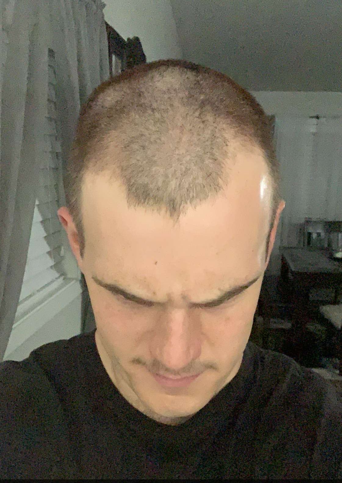 15 Cool Reverse Mohawk Hairstyles for Men - Why tO Makeup