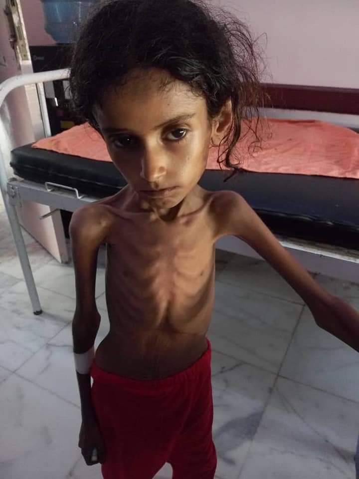 Starving Ethiopian Kids