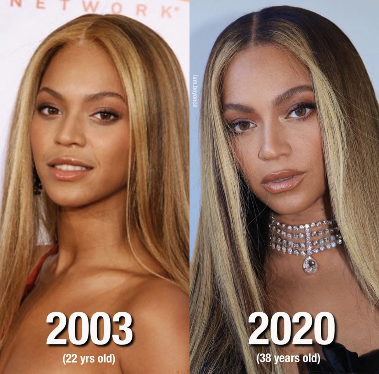 Beyonce Plastic Surgery Comparison Photos | My XXX Hot Girl Beyonce Plastic Surgery Comparison Photos | My XXX Hot Girl