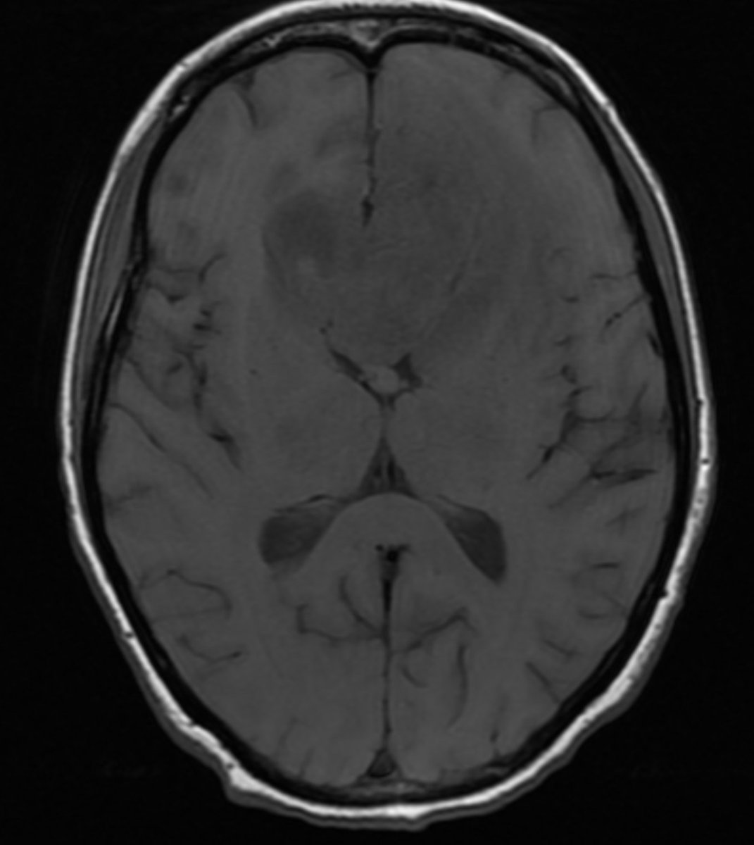 CaseStacks: Radiology Cases, Courses, Resources & Assessments