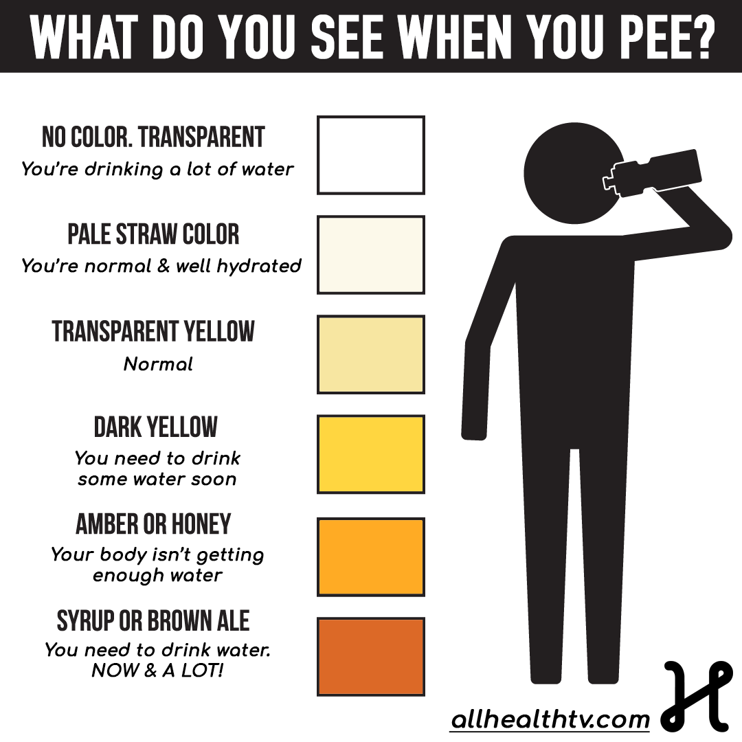 Dark Urine Color Chart
