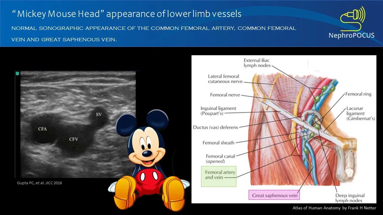 Saphenous Vein Mouse