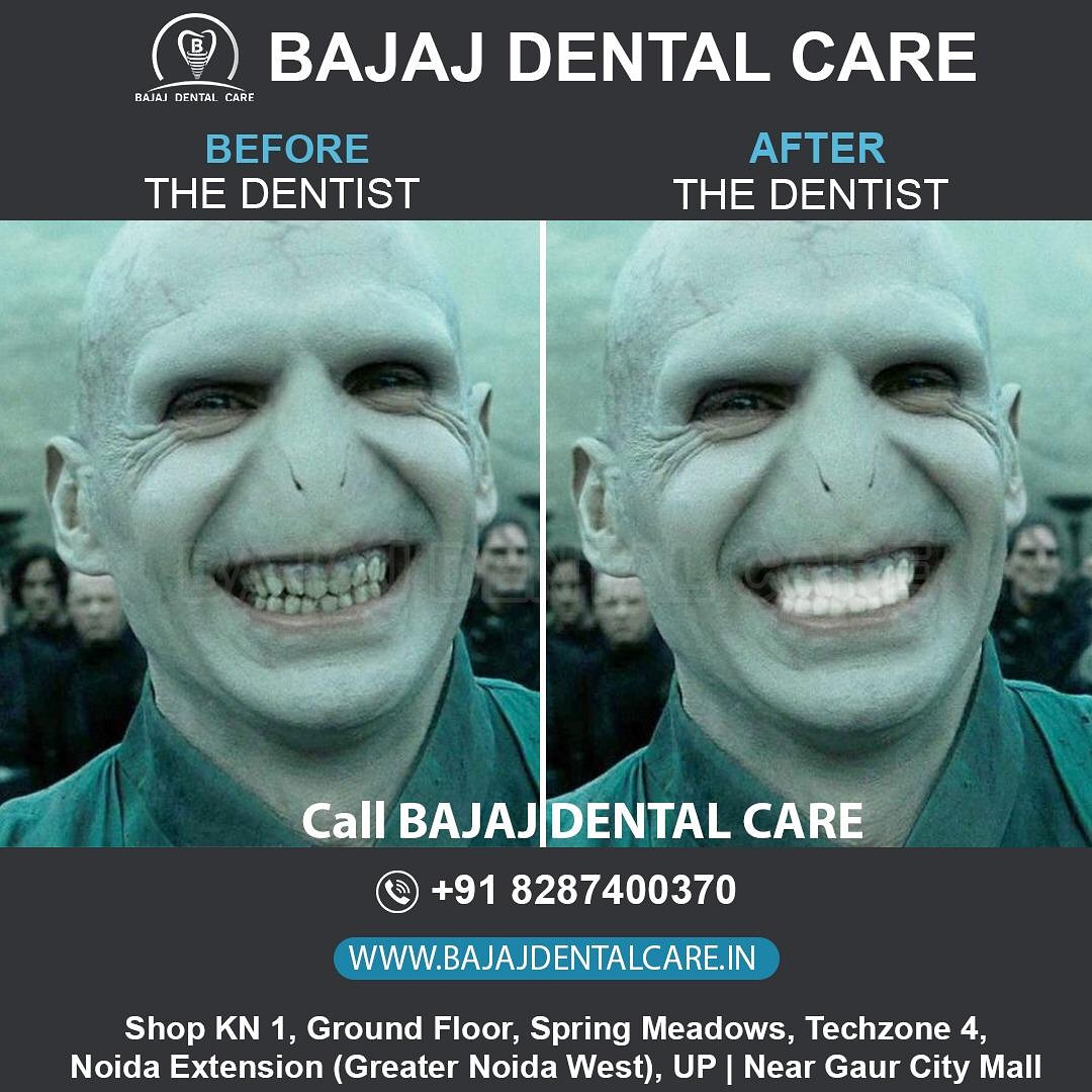 Lord Voldemort Smiling