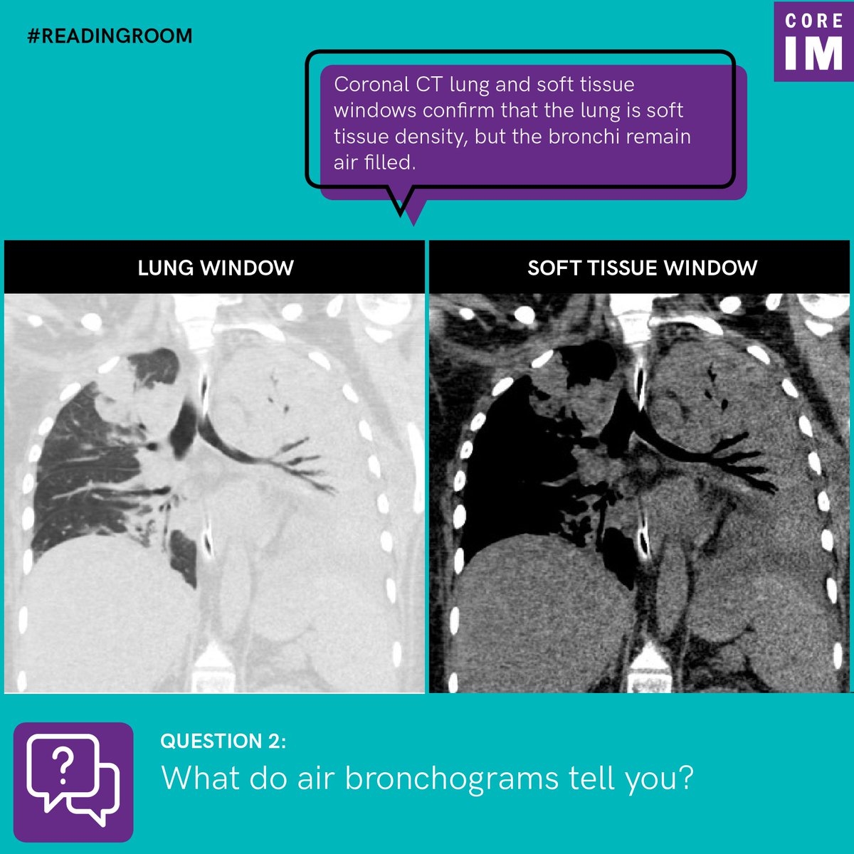 1/ Guess what, #medtwitter! It's time for another round of #ReadingRoom ...