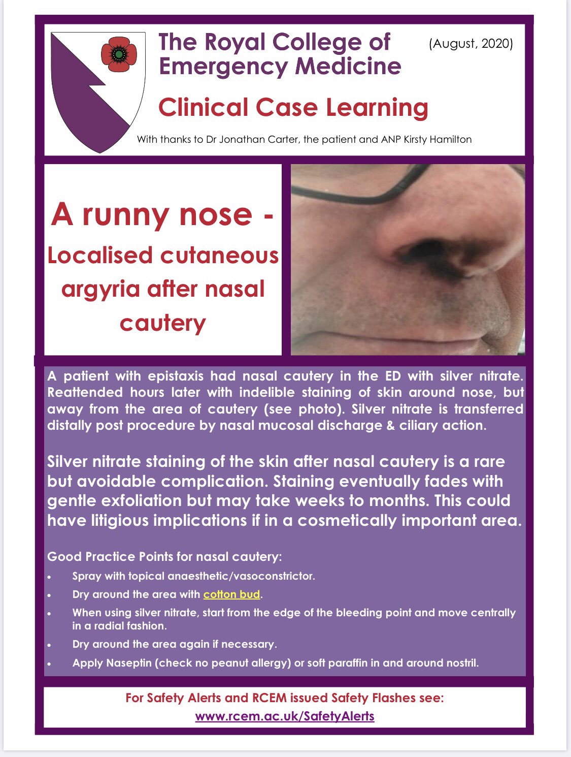 Silver Nitrate Stain