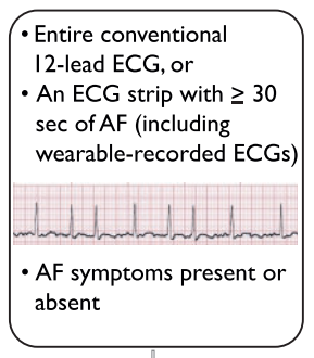 Pulseless Electrical Activity Ecg Strip