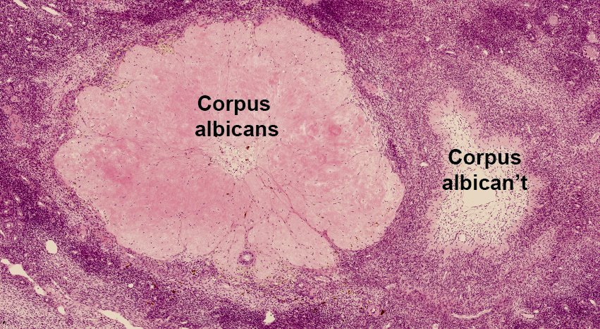 Corpus Albicans Histology Histology Slides 1