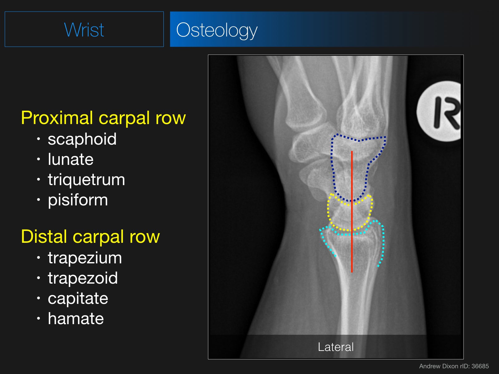 Wrist Anatomy X Ray