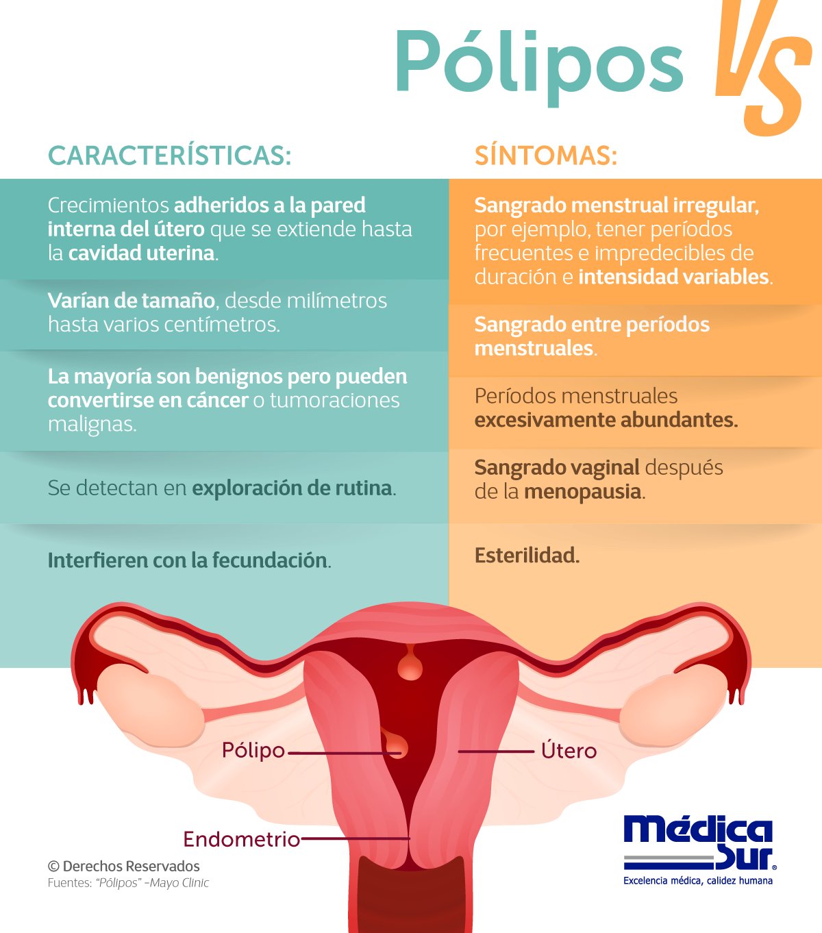 Pólipos Uterinos