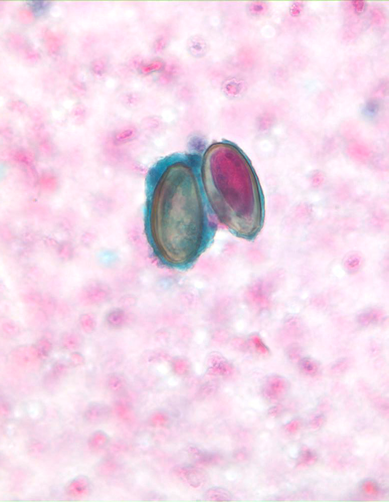 Clonorchis Under Microscope