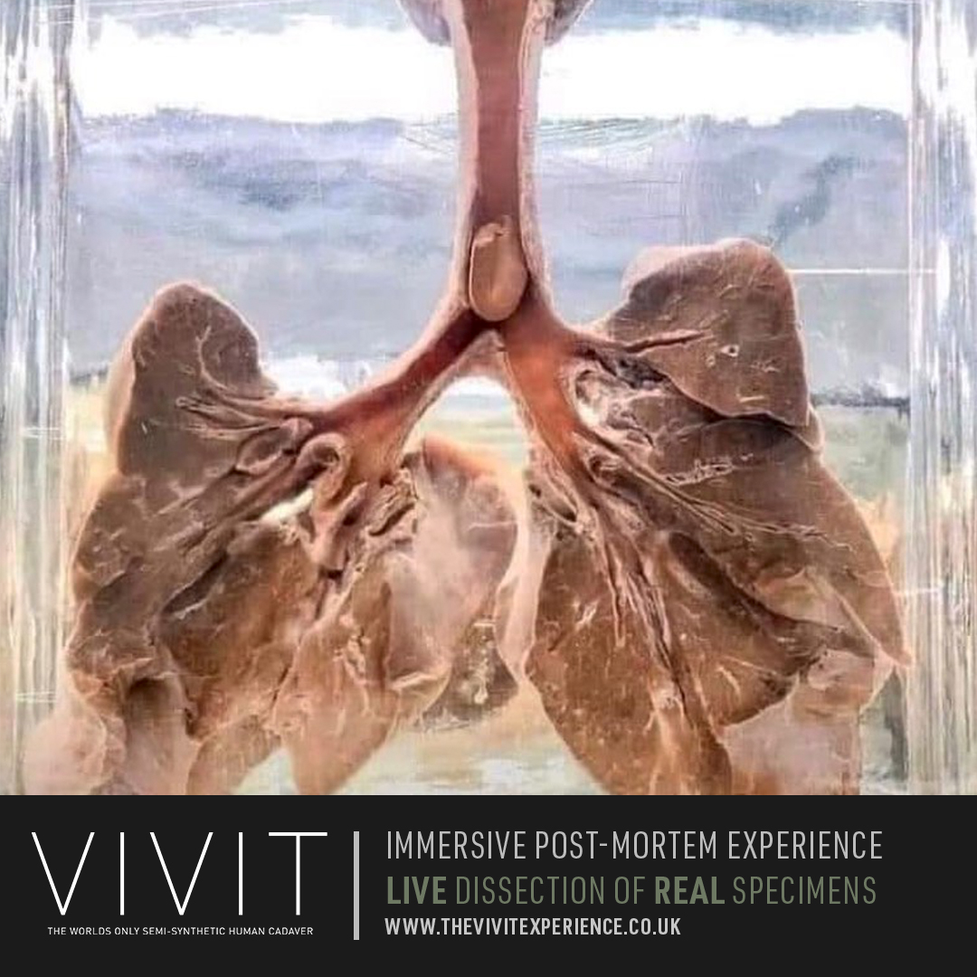 Human Trachea Cadaver