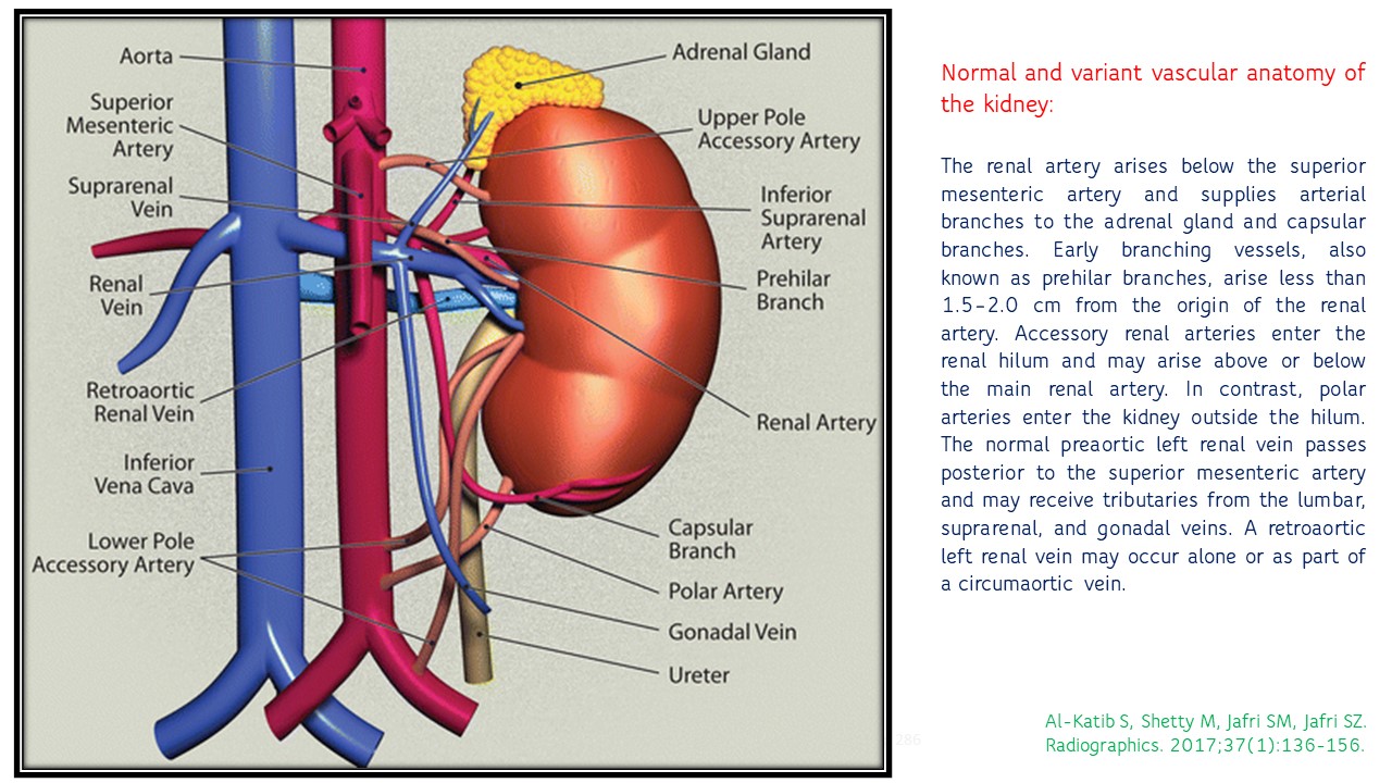 Renal Artery Anatomy Diagram