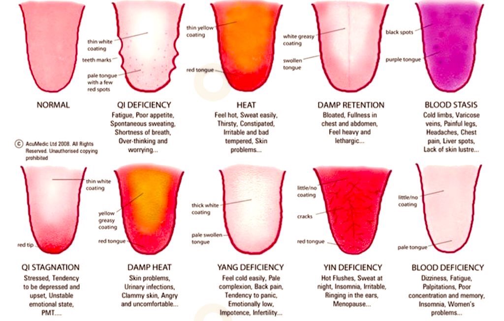 Healthy Tongue Color