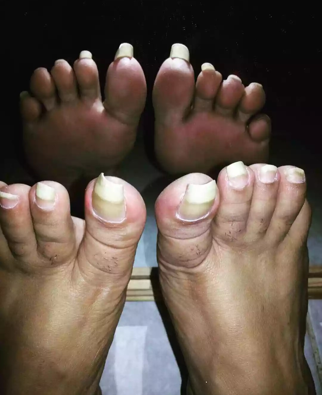 Toenails Obsession On Twitter Pretty Naked Long Toenails