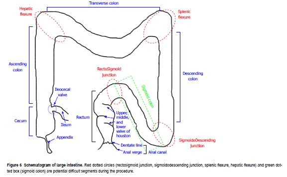 Diagram Of The Rectosigmoid