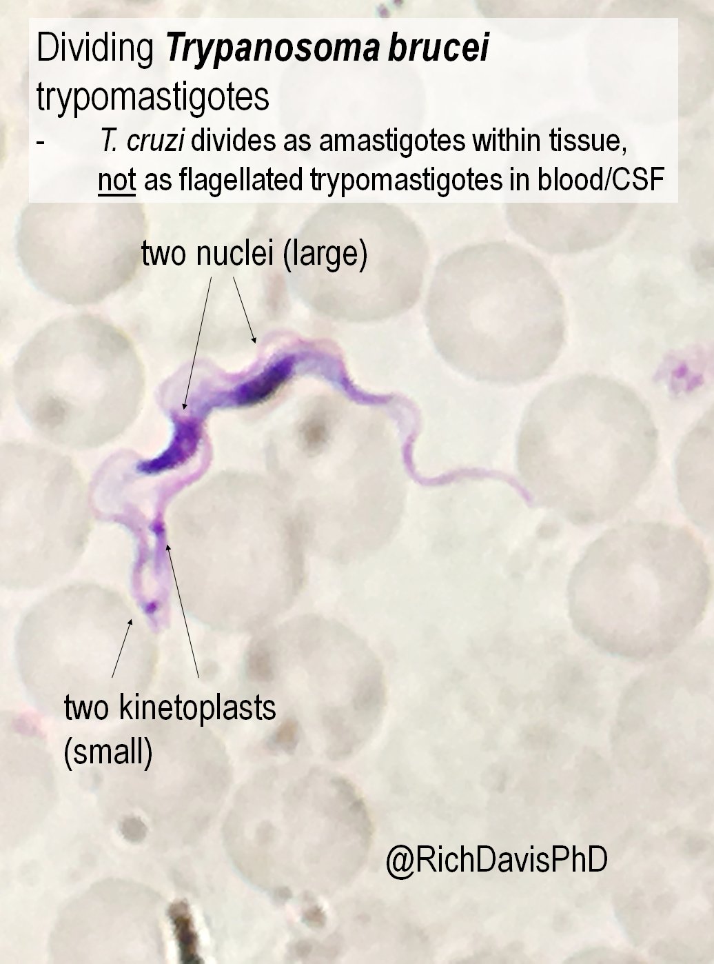 Trypanosoma Under A Microscope