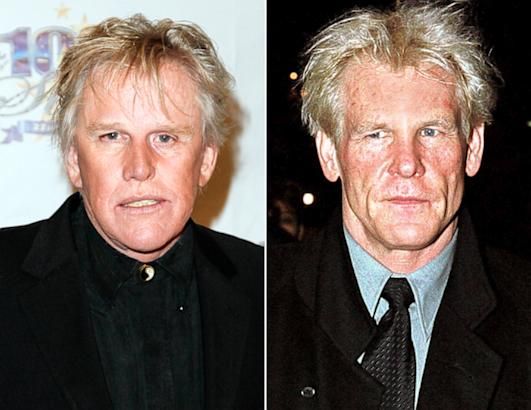 Gary Busey Before And After