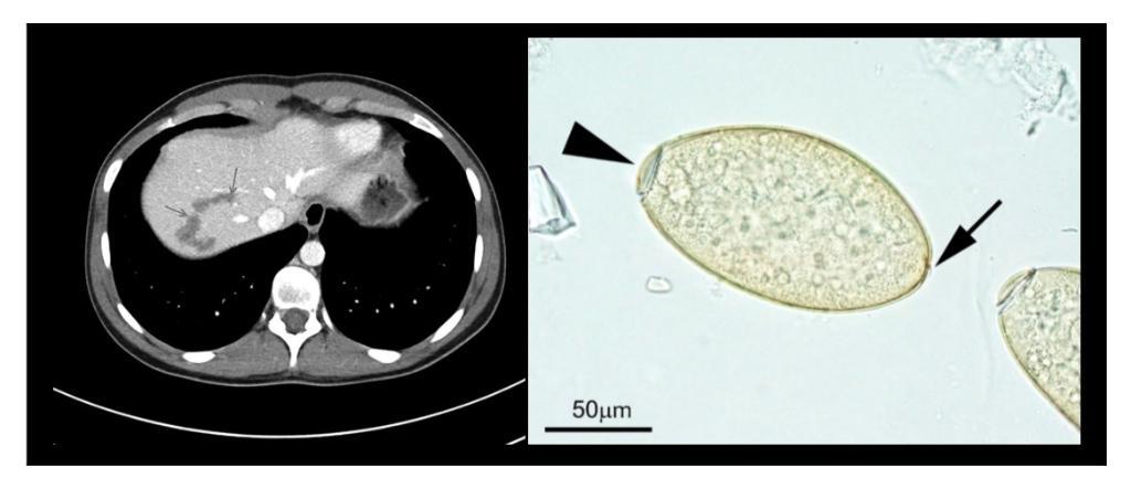 #ScholarlySunday features an “Images of Infectious Diseases” to ...