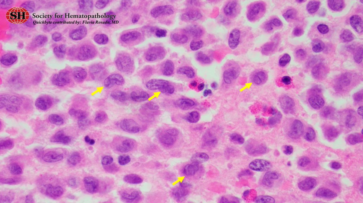 Langerhans Cells Histology