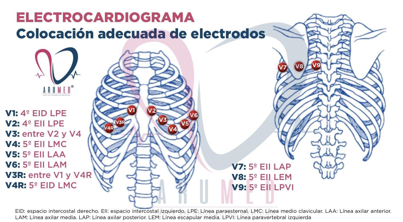 Electrocardiograma