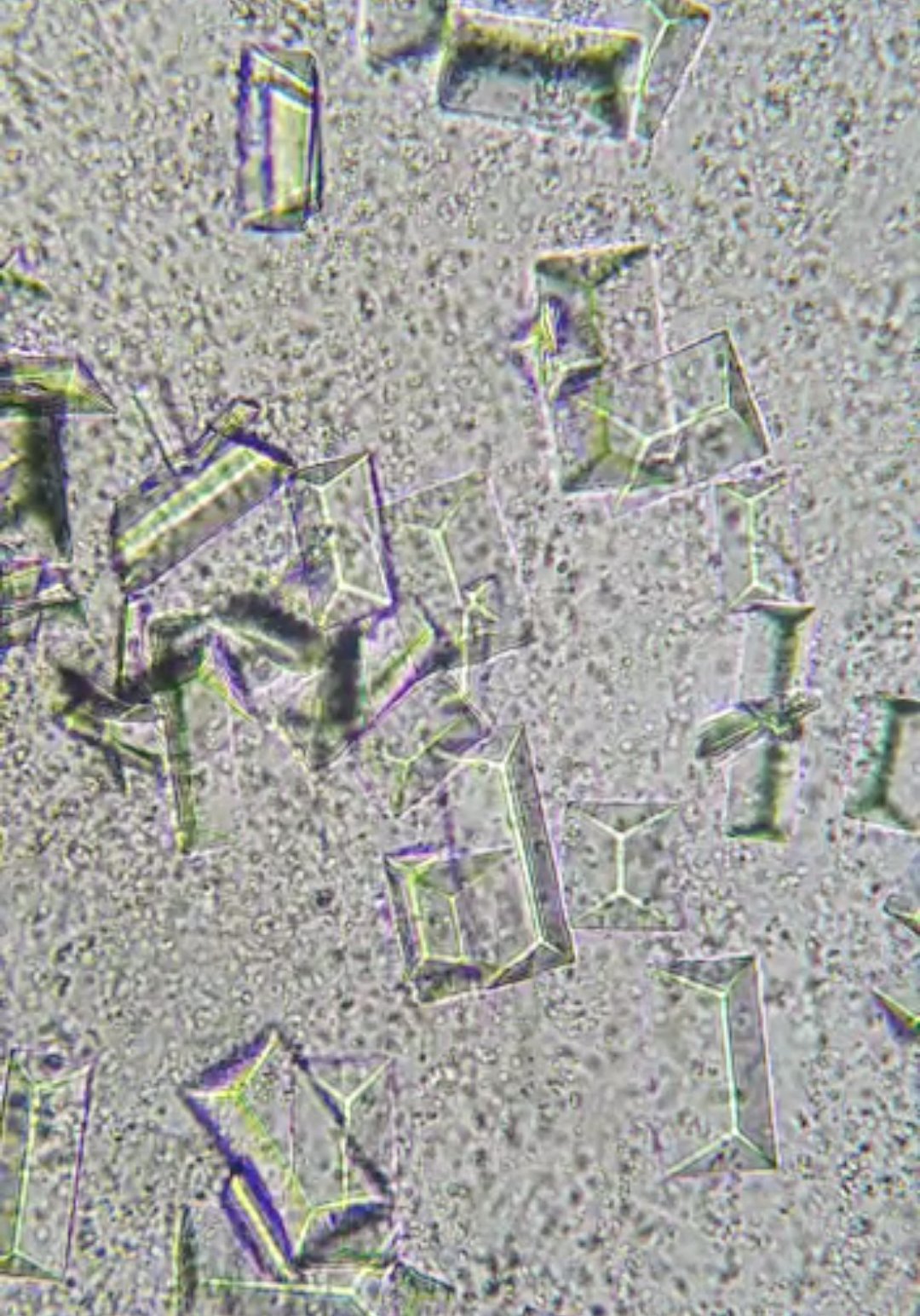 Phosphate Crystals Calcium